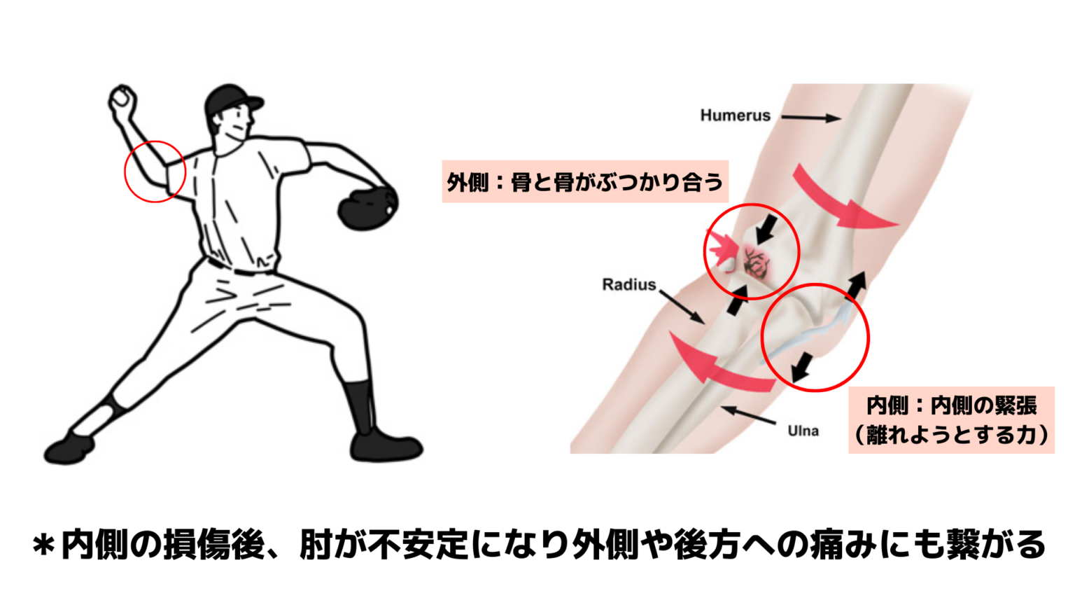 【ボールを投げると痛い！？野球肘について】